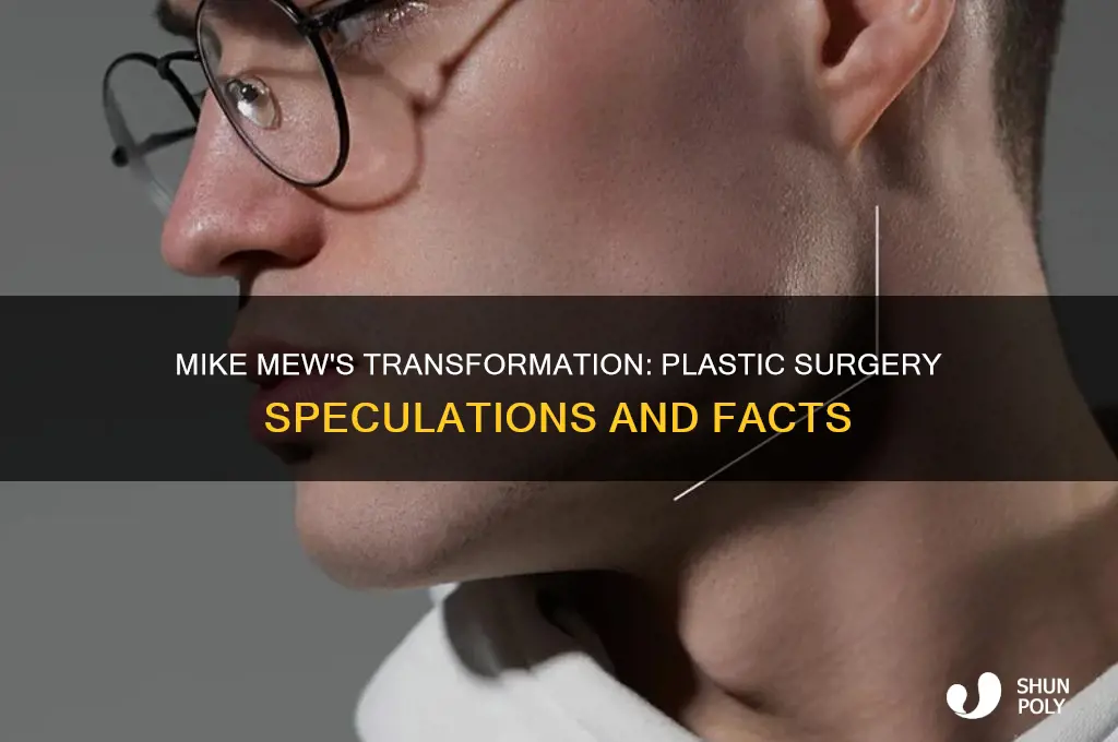 Mike Mew's Transformation: Plastic Surgery Speculations And Facts ...