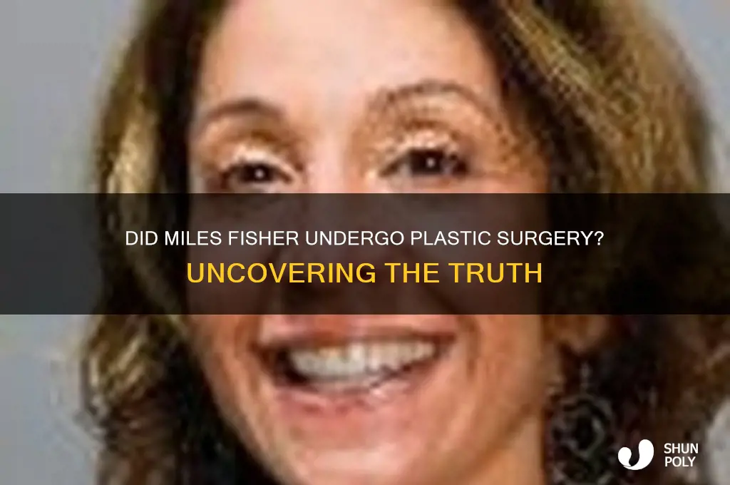 Did Miles Fisher Undergo Plastic Surgery? Uncovering The Truth | ShunPoly