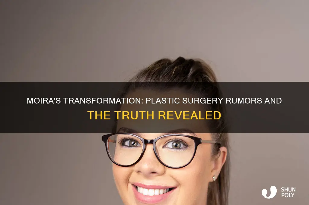 Moira's Transformation: Plastic Surgery Rumors And The Truth Revealed ...