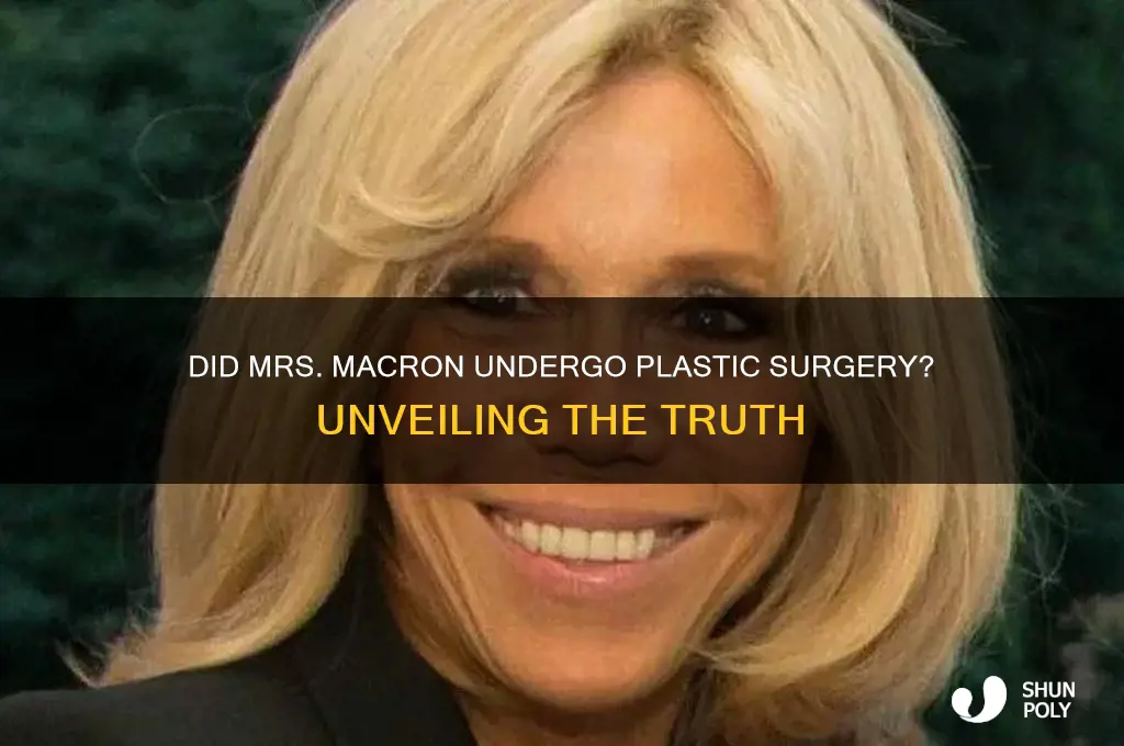 Did Mrs. Macron Undergo Plastic Surgery? Unveiling The Truth | ShunPoly