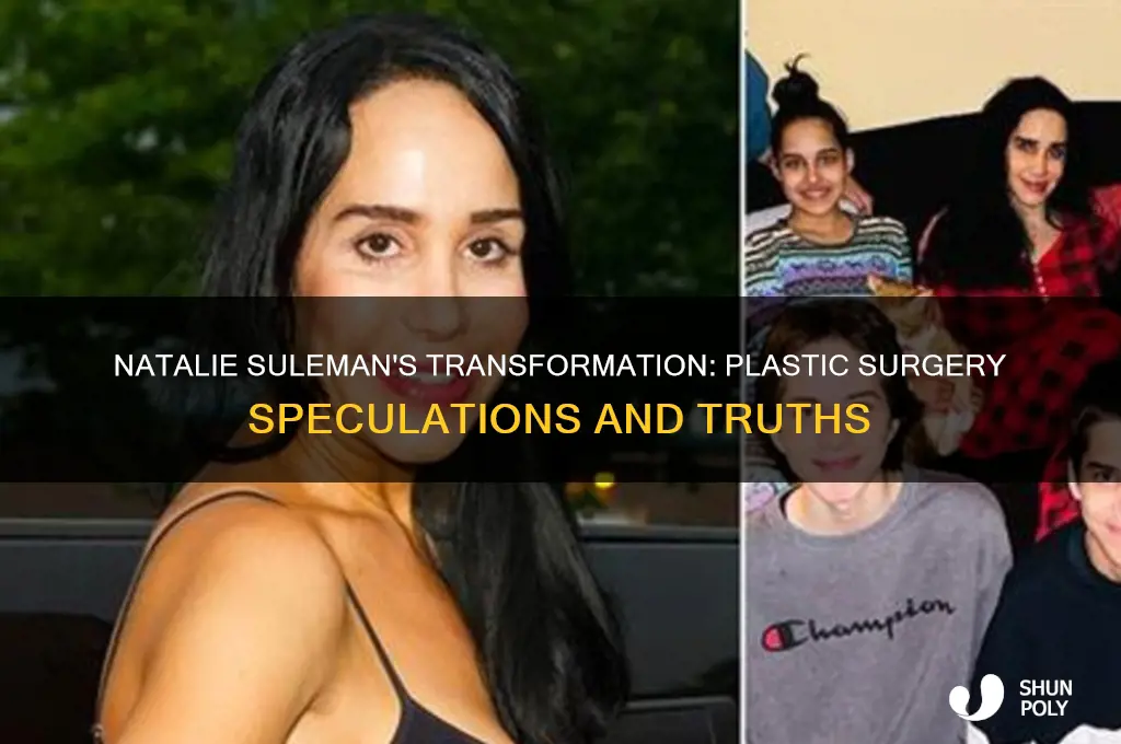 Natalie Suleman's Transformation: Plastic Surgery Speculations And ...