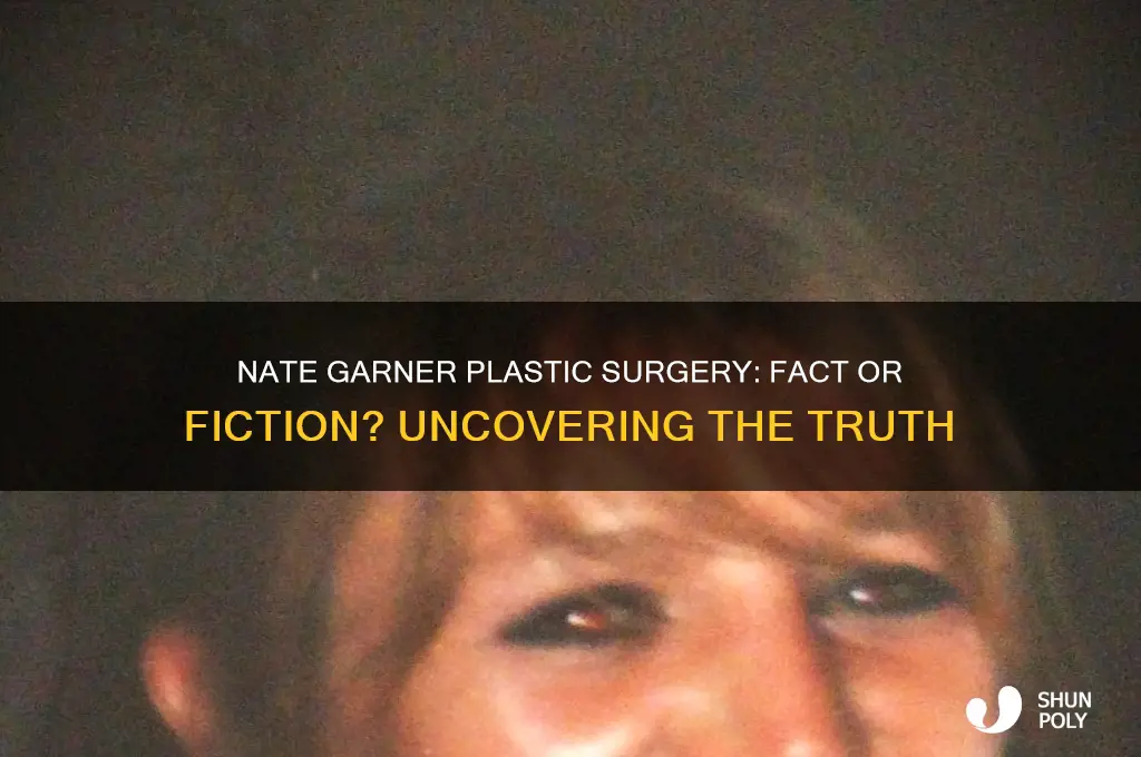 Nate Garner Plastic Surgery: Fact Or Fiction? Uncovering The Truth ...