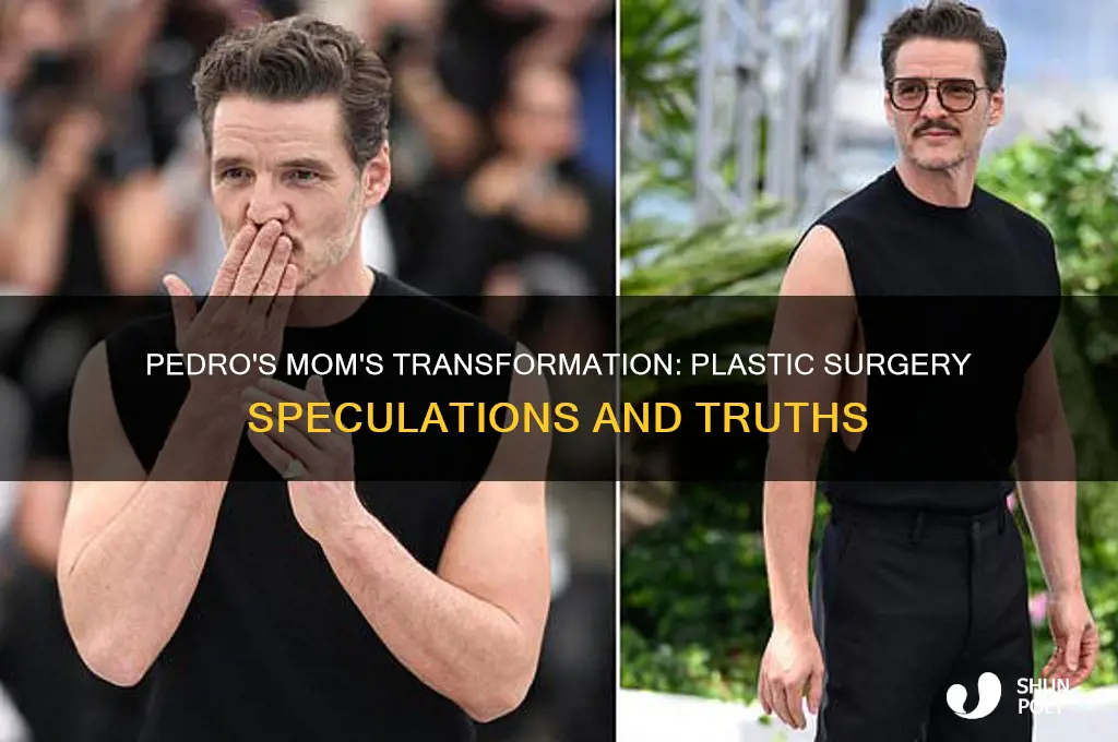 Pedro's Mom's Transformation: Plastic Surgery Speculations And Truths ...