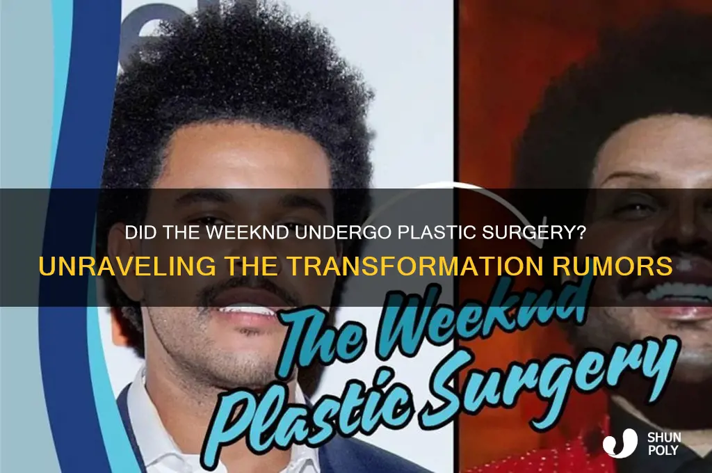 Did The Weeknd Undergo Plastic Surgery? Unraveling The Transformation ...