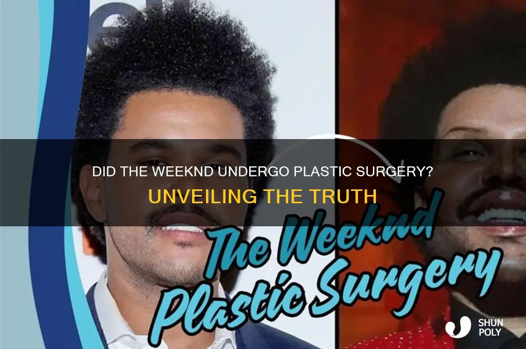 Did The Weeknd Undergo Plastic Surgery? Unveiling The Truth | ShunPoly