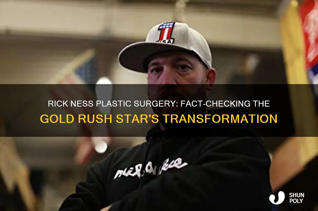 Rick Ness Plastic Surgery: Fact-Checking The Gold Rush Star's ...