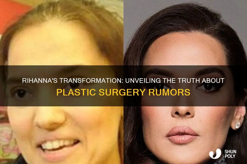 Rihanna's Transformation: Unveiling The Truth About Plastic Surgery ...
