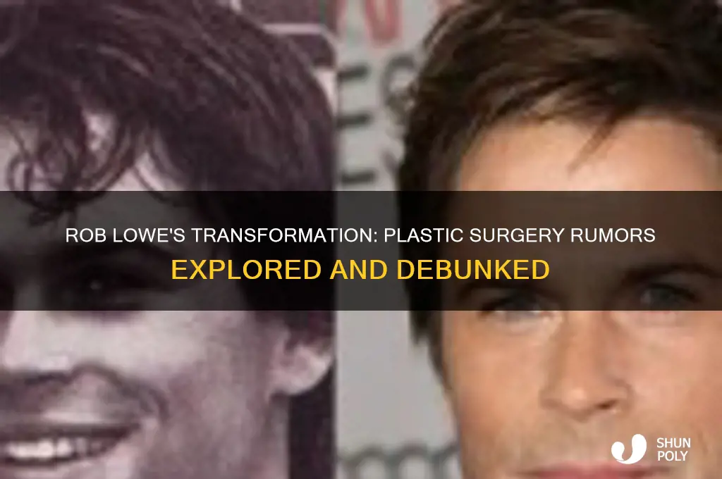 Rob Lowe's Transformation: Plastic Surgery Rumors Explored And Debunked ...