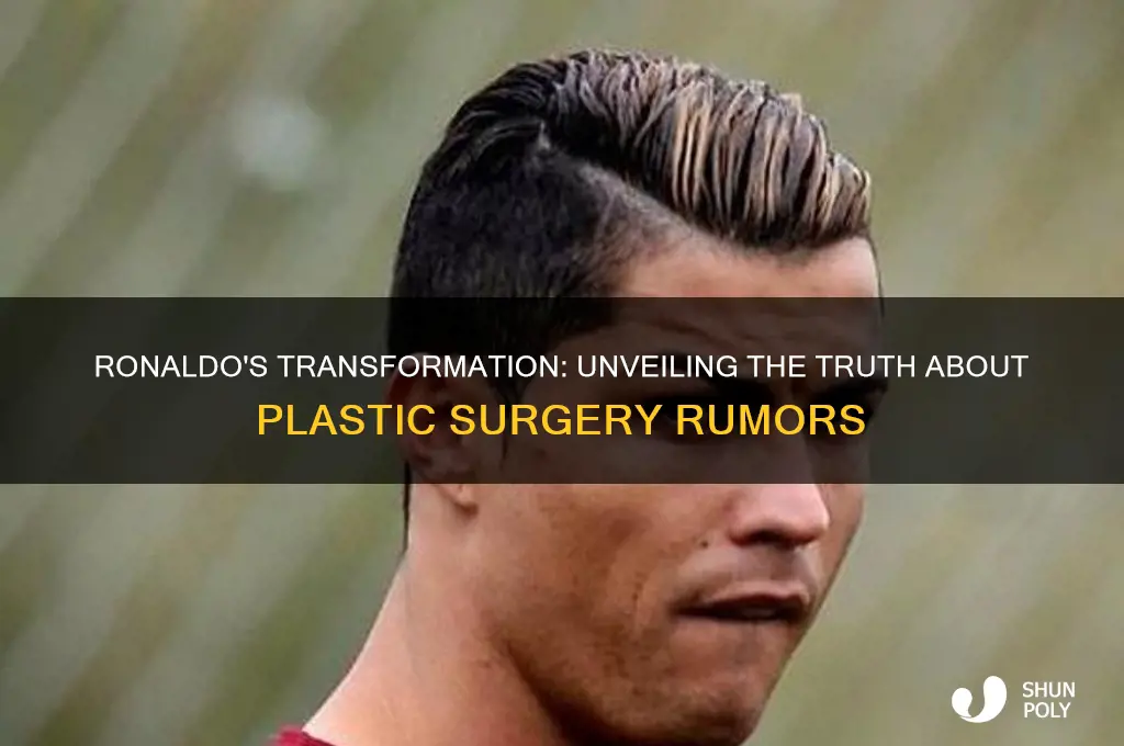 Ronaldo's Transformation: Unveiling The Truth About Plastic Surgery ...