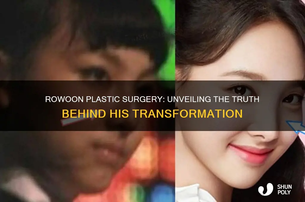 Rowoon Plastic Surgery: Unveiling The Truth Behind His Transformation ...