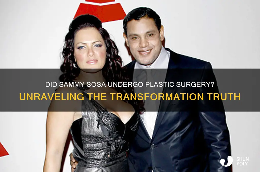 Did Sammy Sosa Undergo Plastic Surgery? Unraveling The Transformation ...
