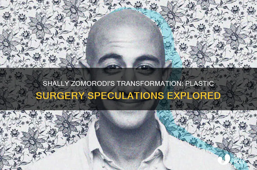Shally Zomorodi's Transformation: Plastic Surgery Speculations Explored ...