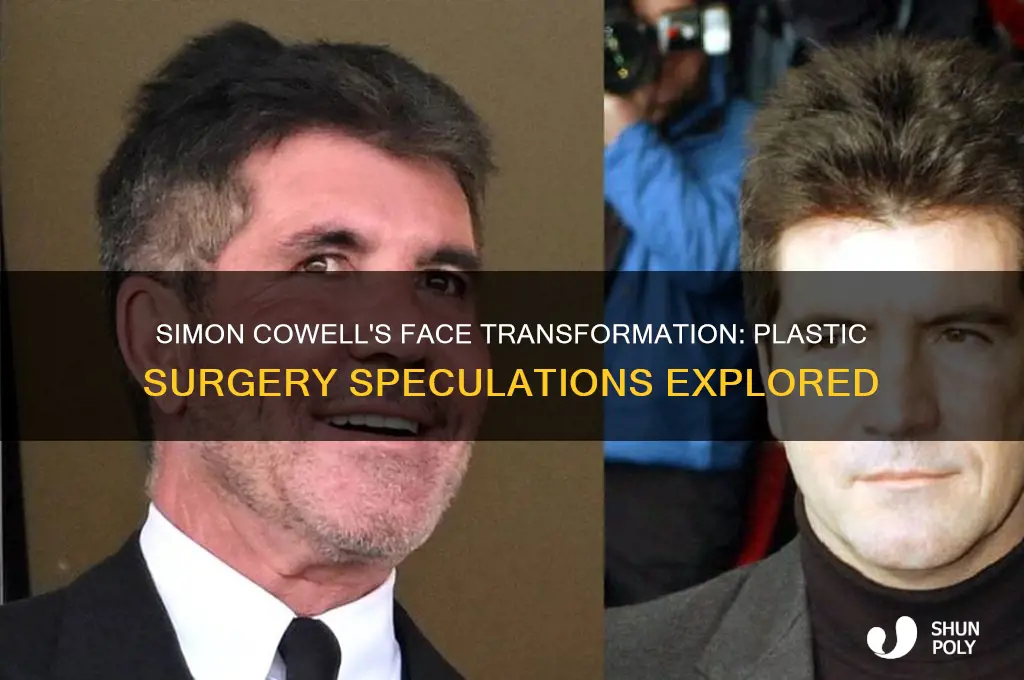 Simon Cowell's Face Transformation: Plastic Surgery Speculations ...