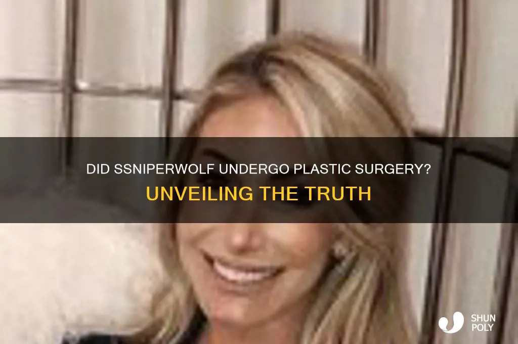 Did Ssniperwolf Undergo Plastic Surgery? Unveiling The Truth | ShunPoly