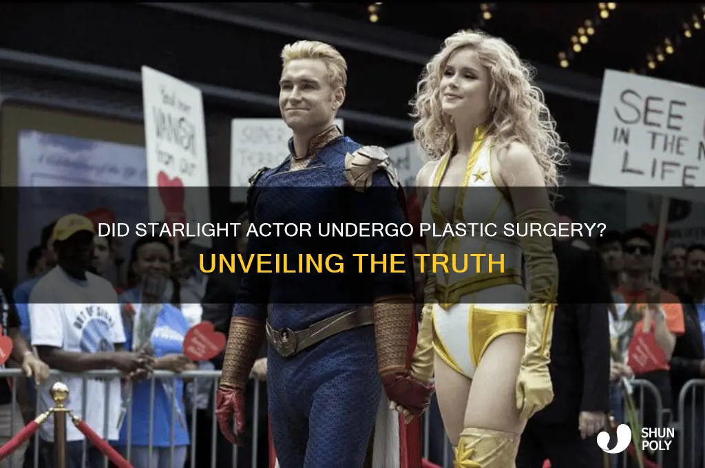 Did Starlight Actor Undergo Plastic Surgery? Unveiling The Truth | ShunPoly