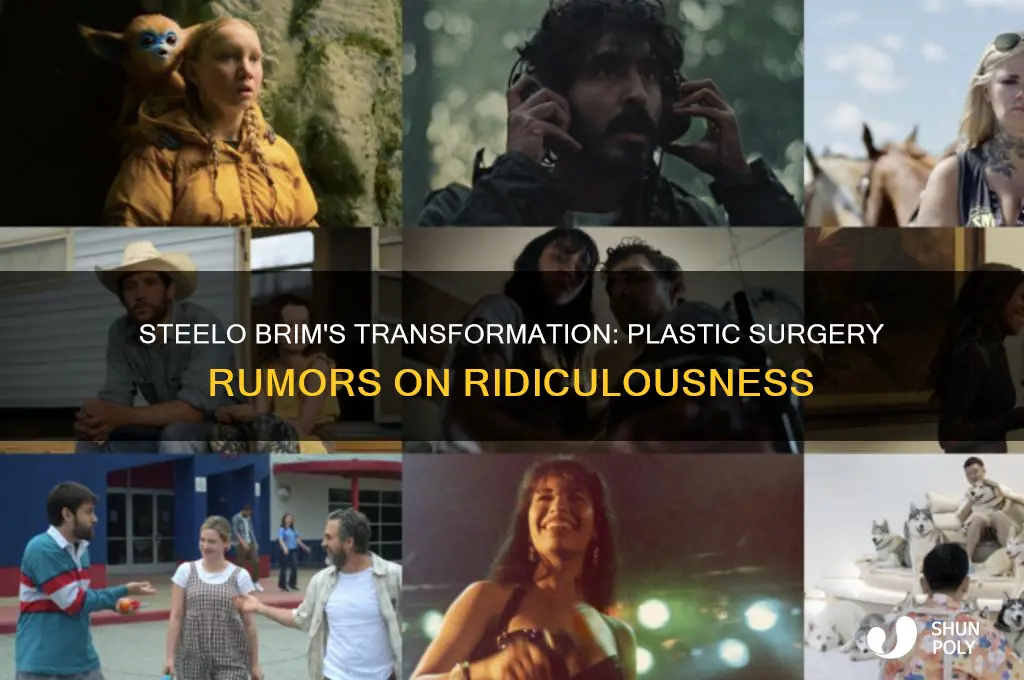 Steelo Brim's Transformation: Plastic Surgery Rumors On Ridiculousness ...