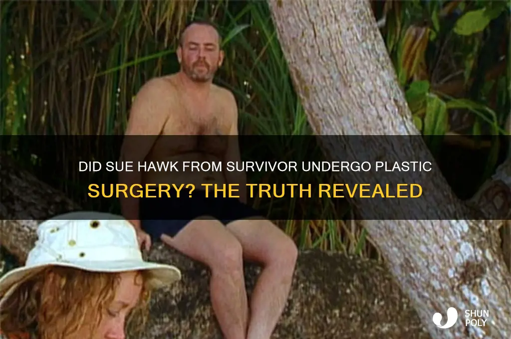 Did Sue Hawk From Survivor Undergo Plastic Surgery? The Truth Revealed ...