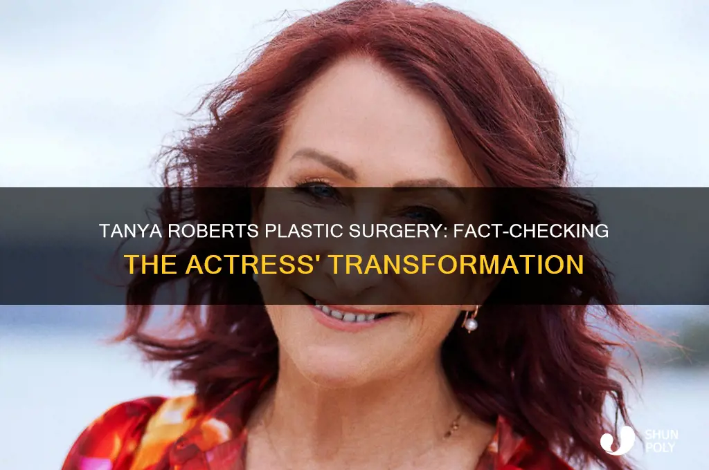 Tanya Roberts Plastic Surgery: Fact-Checking The Actress ...