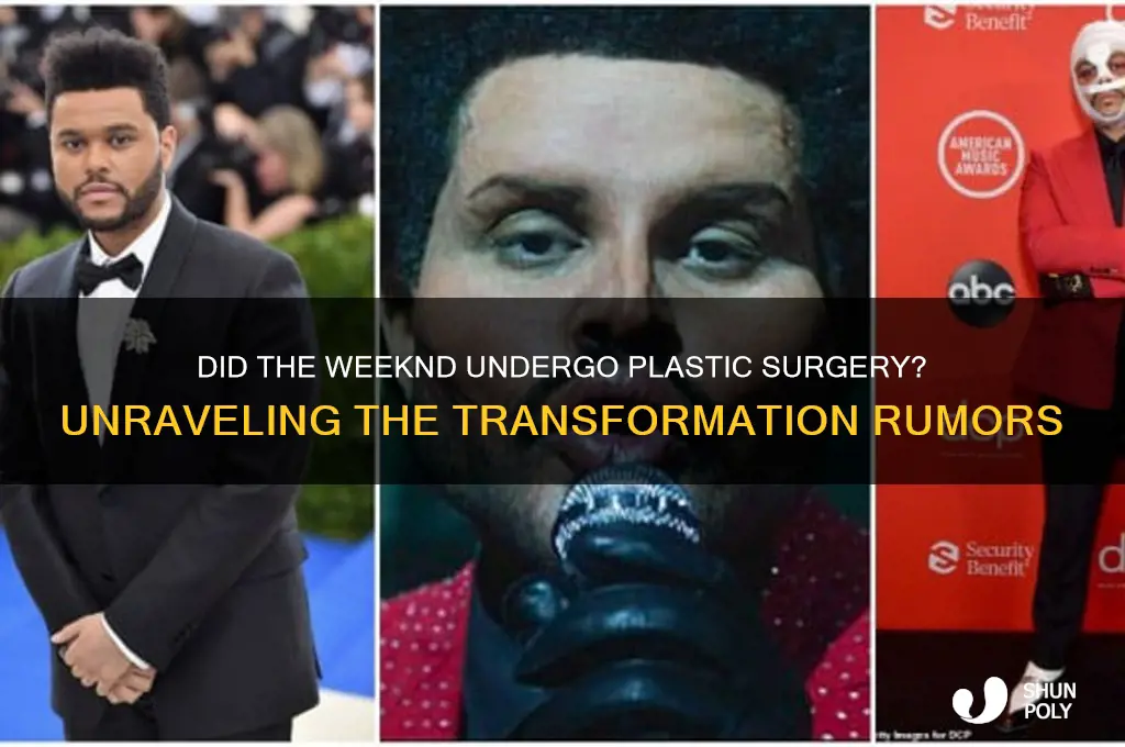 Did The Weeknd Undergo Plastic Surgery? Unraveling The Transformation ...