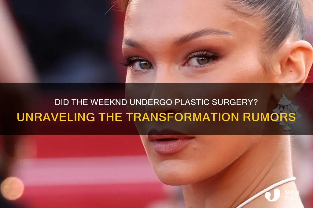 Did The Weeknd Undergo Plastic Surgery? Unraveling The Transformation ...
