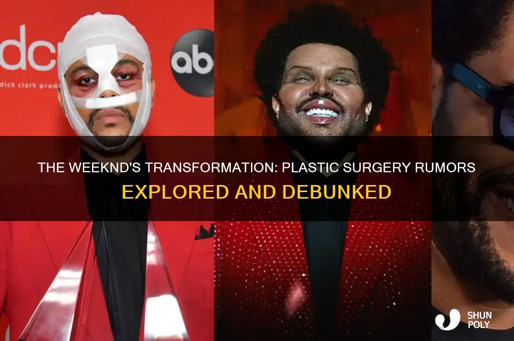 The Weeknd's Transformation: Plastic Surgery Rumors Explored And ...
