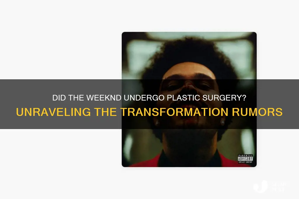 Did The Weeknd Undergo Plastic Surgery? Unraveling The Transformation ...