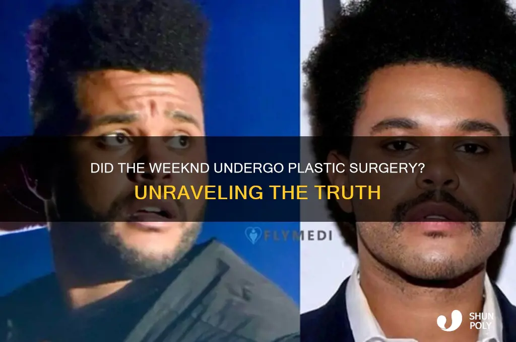 Did The Weeknd Undergo Plastic Surgery? Unraveling The Truth | ShunPoly