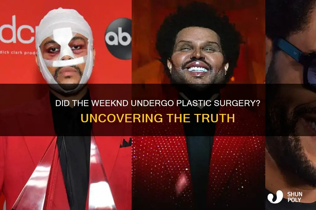 Did The Weeknd Undergo Plastic Surgery? Uncovering The Truth | ShunPoly