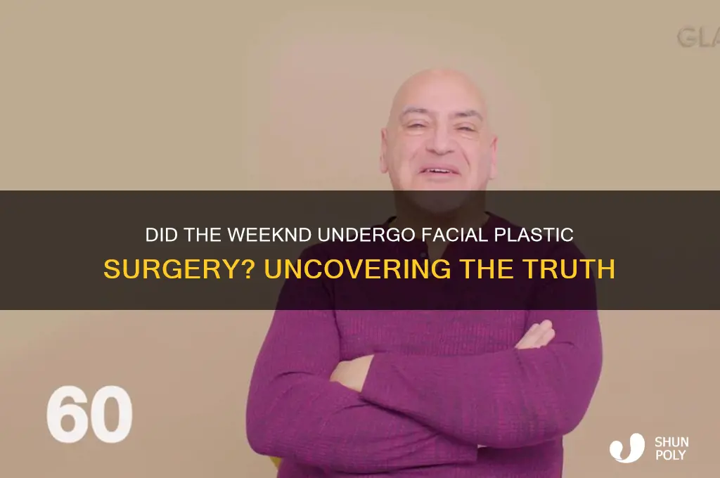 Did The Weeknd Undergo Facial Plastic Surgery? Uncovering The Truth ...