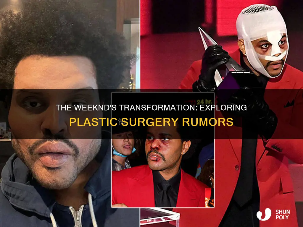 The Weeknd's Transformation: Exploring Plastic Surgery Rumors | ShunPoly