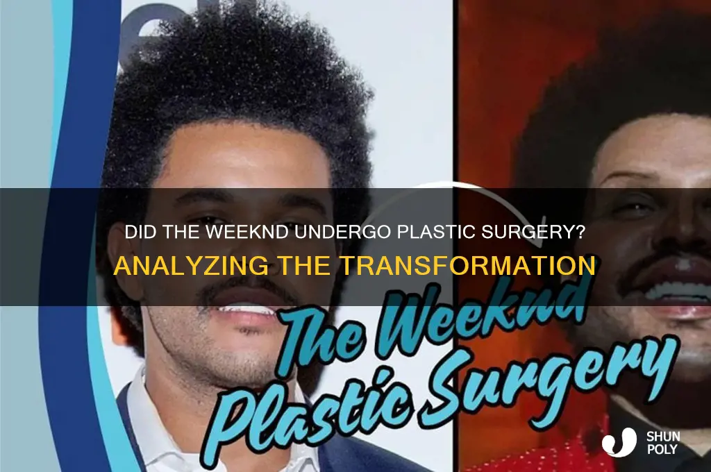 Did The Weeknd Undergo Plastic Surgery? Analyzing The Transformation ...