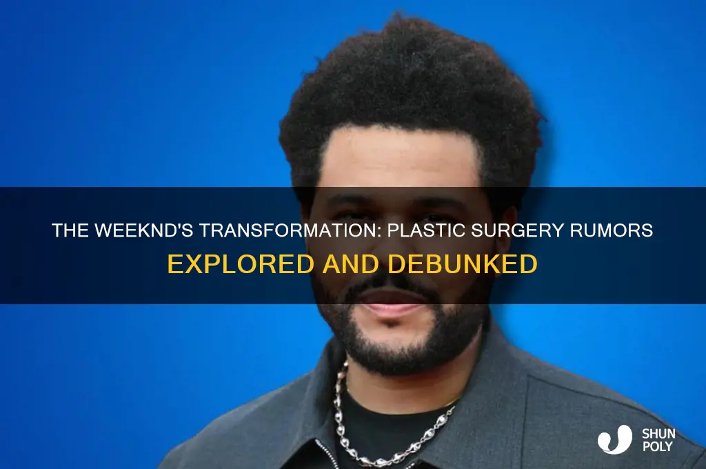 The Weeknd's Transformation: Plastic Surgery Rumors Explored And ...