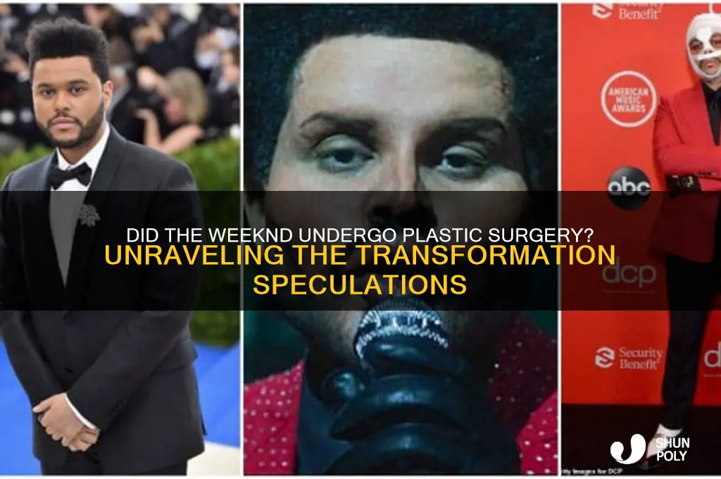 Did The Weeknd Undergo Plastic Surgery? Unraveling The Transformation ...