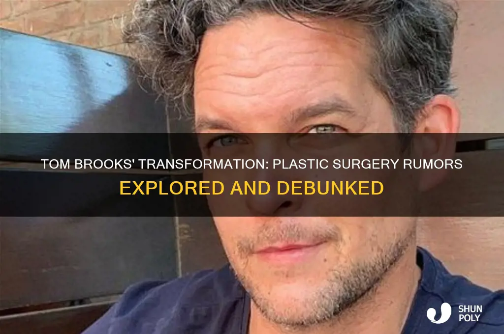 Tom Brooks' Transformation: Plastic Surgery Rumors Explored And ...