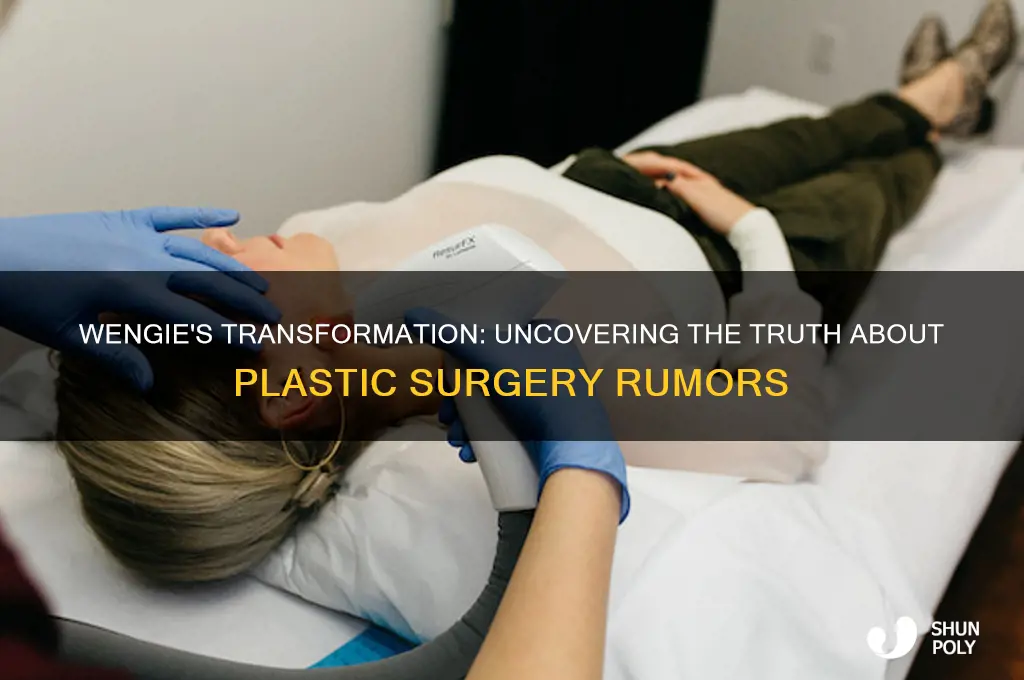 Wengie's Transformation: Uncovering The Truth About Plastic Surgery ...