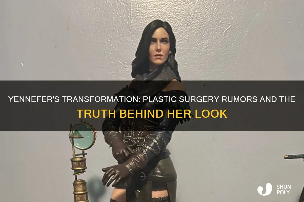 Yennefer's Transformation: Plastic Surgery Rumors And The Truth Behind ...