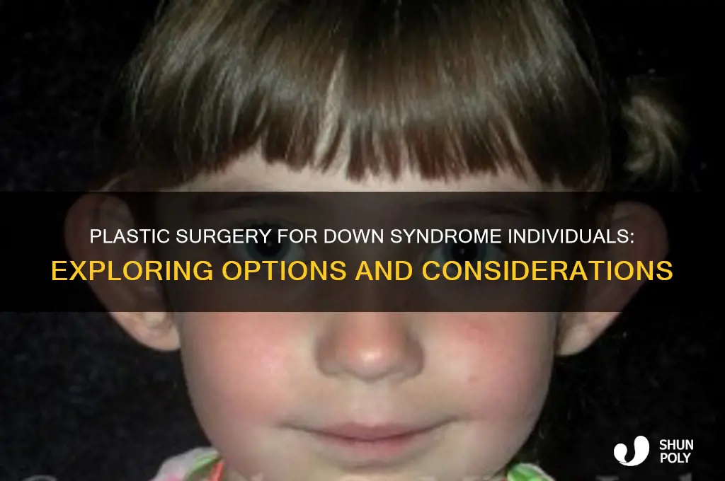 Plastic Surgery For Down Syndrome Individuals: Exploring Options And ...