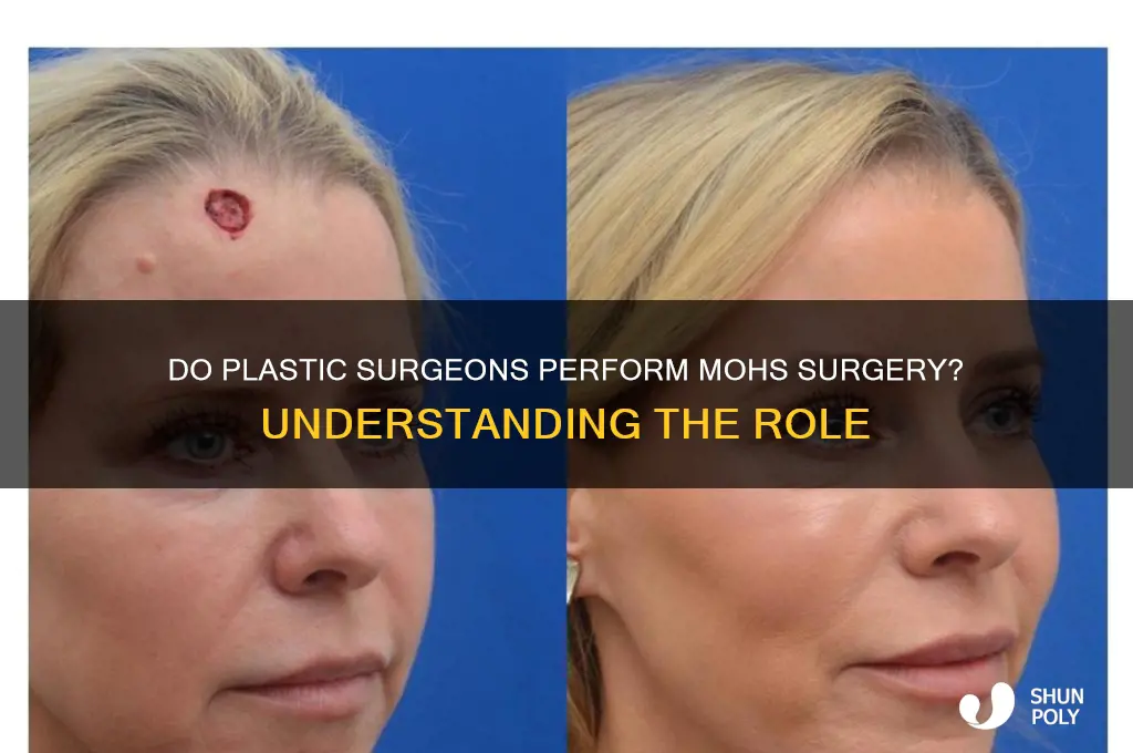 Do Plastic Surgeons Perform Mohs Surgery? Understanding The Role | ShunPoly