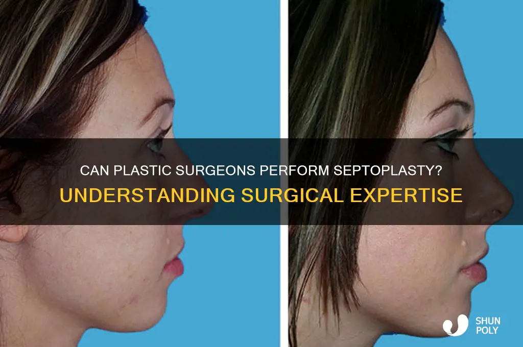 Can Plastic Surgeons Perform Septoplasty? Understanding Surgical ...