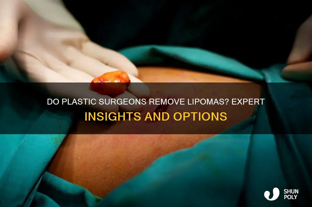 Do Plastic Surgeons Remove Lipomas? Expert Insights And Options | ShunPoly