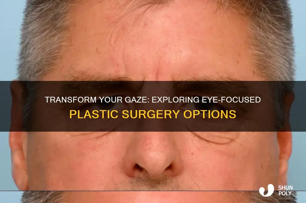 Transform Your Gaze: Exploring Eye-Focused Plastic Surgery Options ...