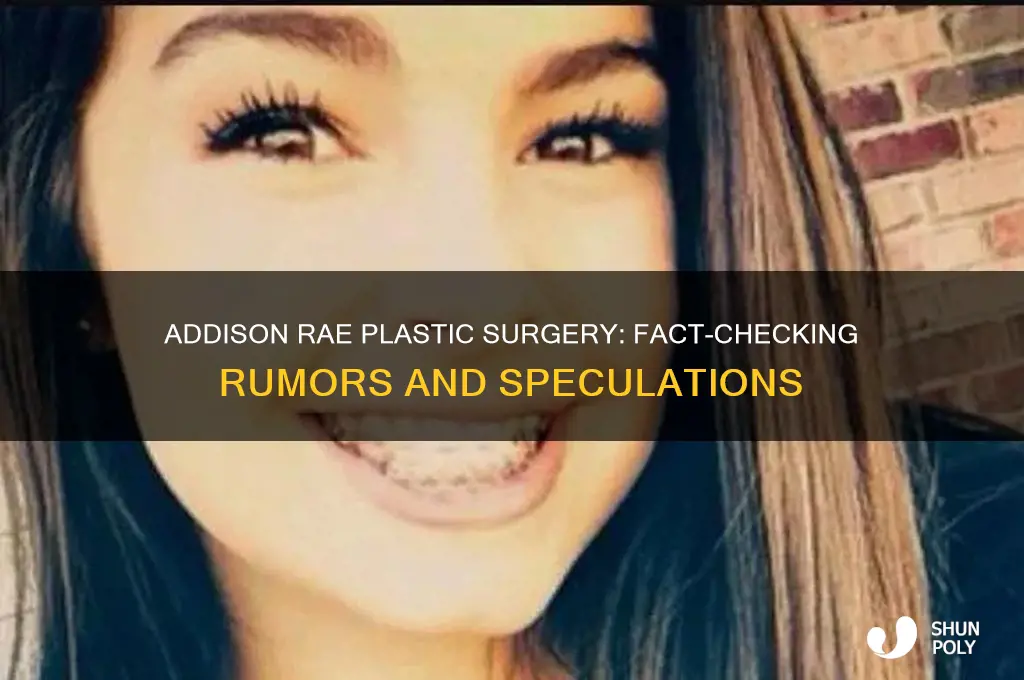 Addison Rae Plastic Surgery: Fact-Checking Rumors And Speculations ...