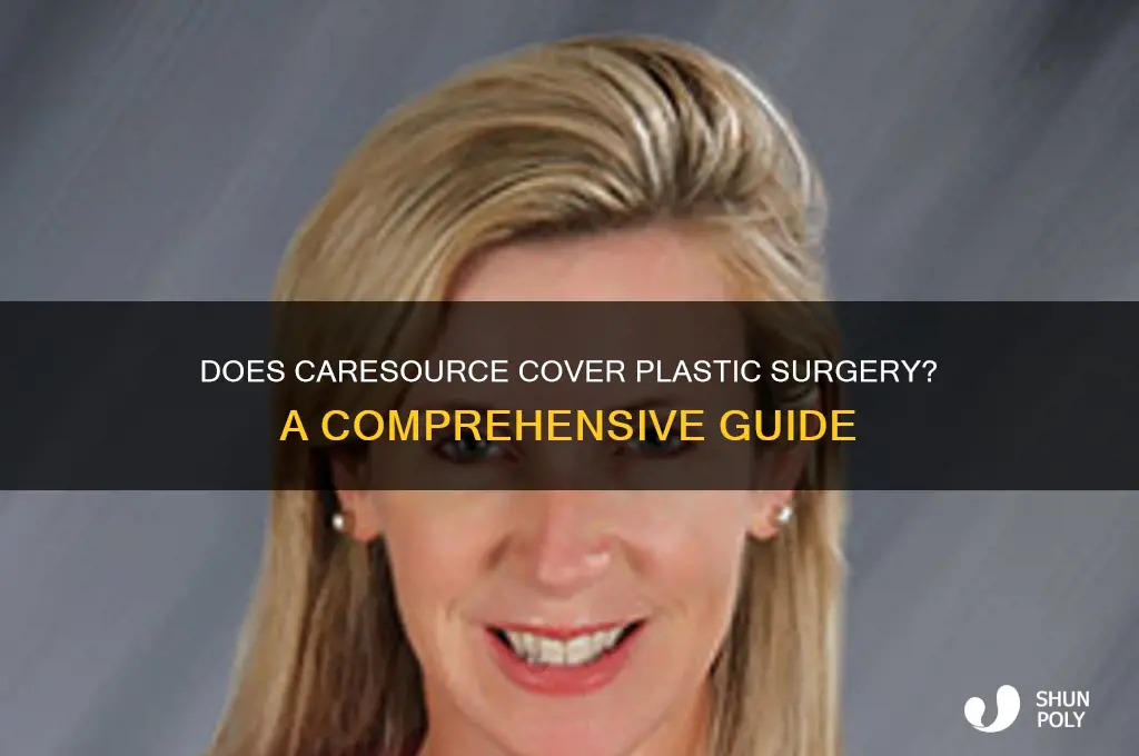 Does Caresource Cover Plastic Surgery? A Comprehensive Guide | ShunPoly