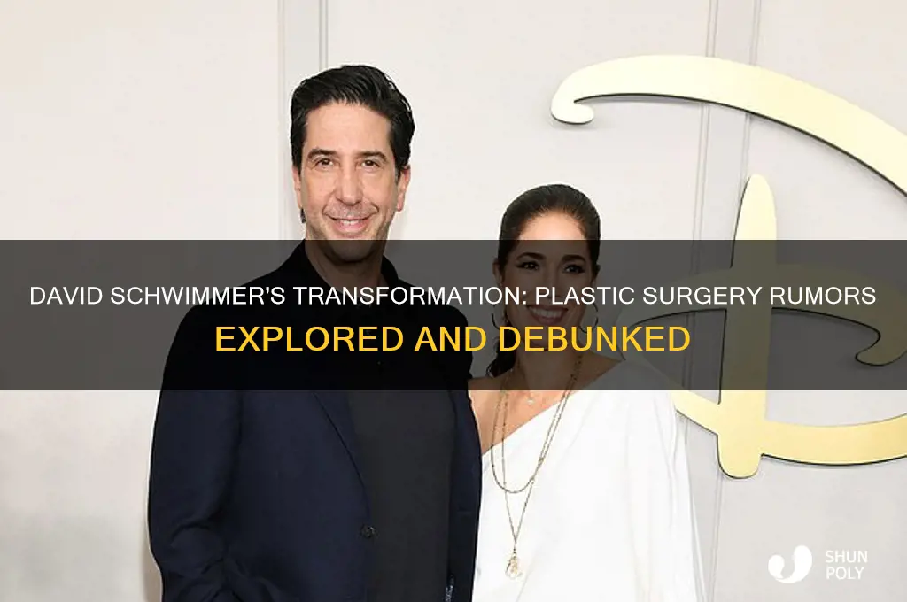 David Schwimmer's Transformation: Plastic Surgery Rumors Explored And ...