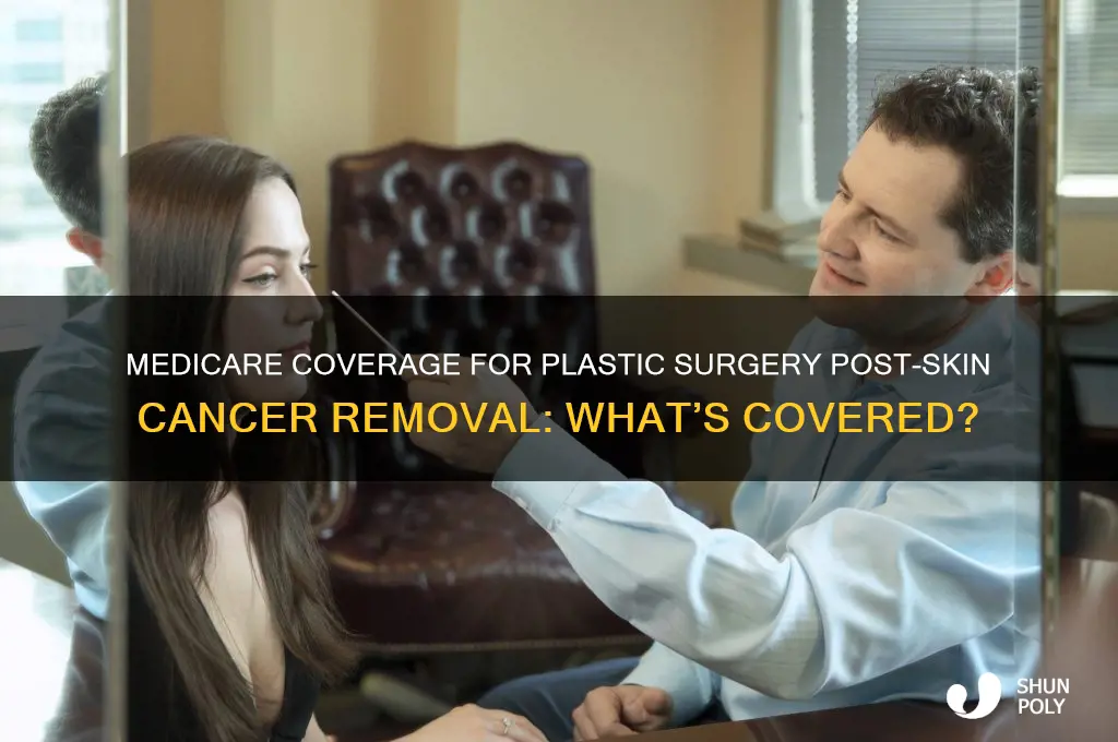 Medicare Coverage For Plastic Surgery Post-Skin Cancer Removal: What’S ...