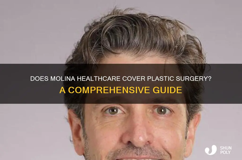 Does Molina Healthcare Cover Plastic Surgery? A Comprehensive Guide ...