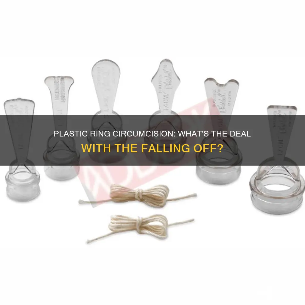 Plastic Ring Circumcision: What's The Deal With The Falling Off? | ShunPoly
