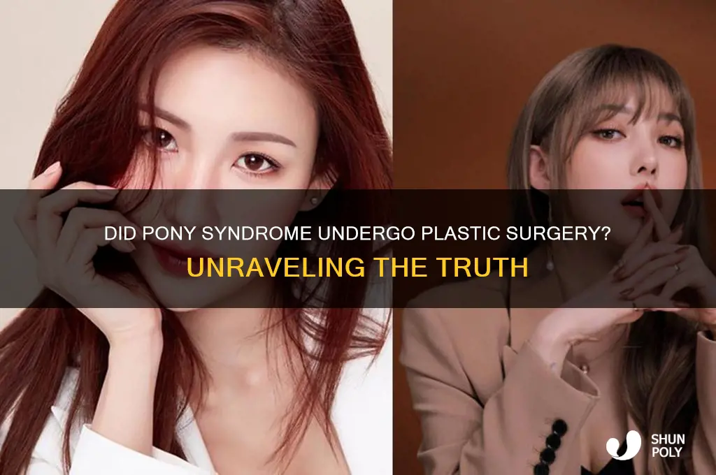 Did Pony Syndrome Undergo Plastic Surgery? Unraveling The Truth | ShunPoly