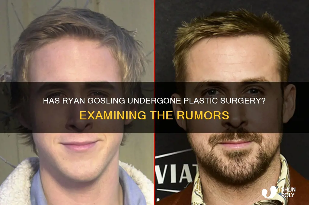 Has Ryan Gosling Undergone Plastic Surgery? Examining The Rumors | ShunPoly