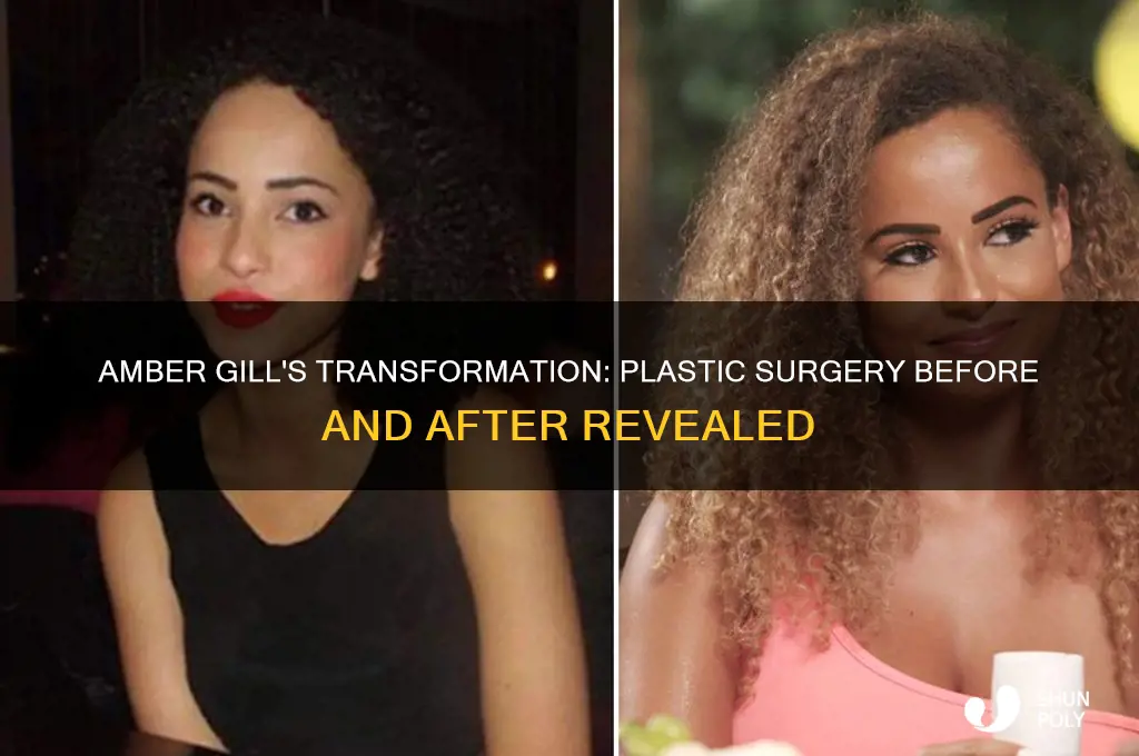 Amber Gill's Transformation: Plastic Surgery Before And After Revealed ...